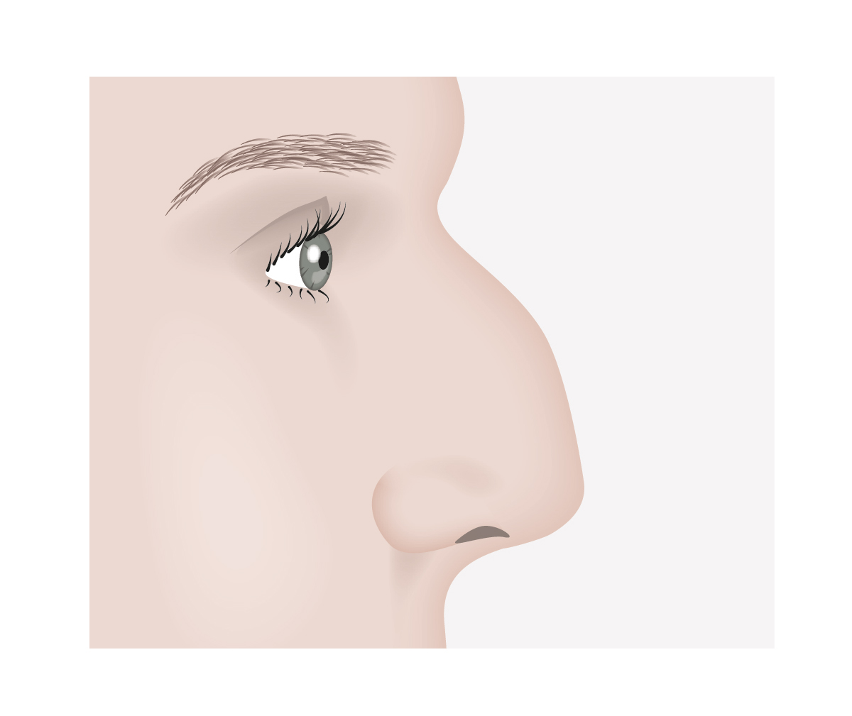 Nasenkorrektur - Form Gesicht und Straffung - Aesthea